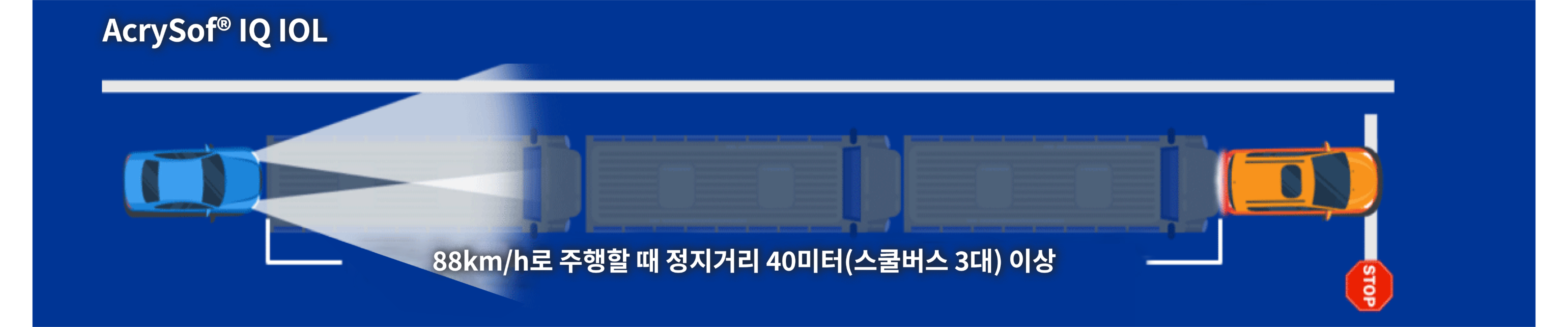 Acryof IQ Monofocal and AcrySof IQ Toric IOL | MyAlcon | Korea